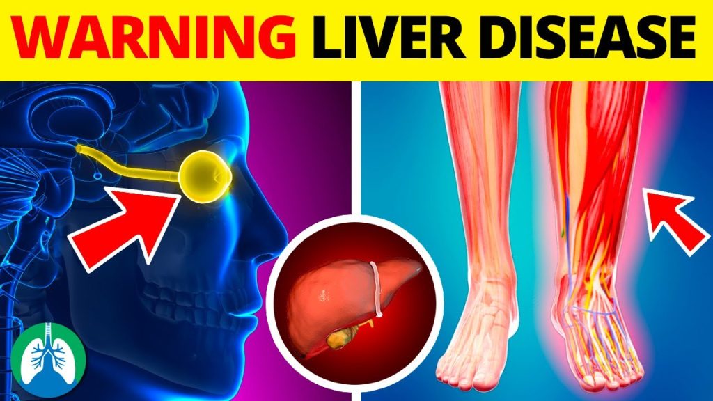 10 Symptoms of Liver Damage: How to Know if Your Liver is in Trouble ...